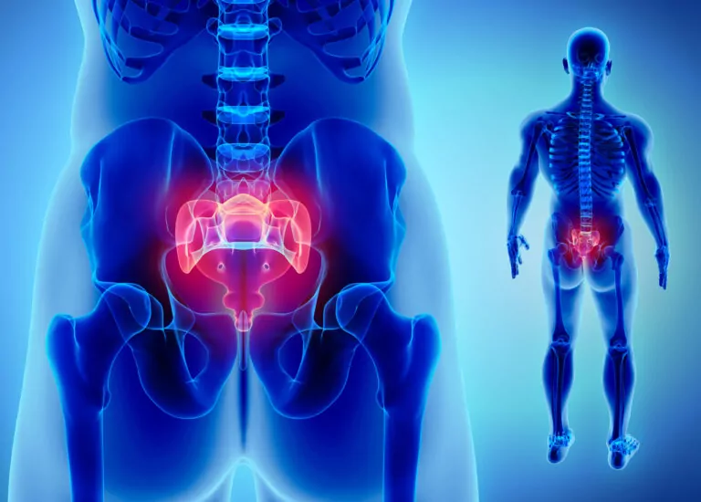 Tailbone Pain Causes, Symptoms, and Treatment - PMIR Tailbone Pain Causes, Symptoms, and Treatment - PMIR